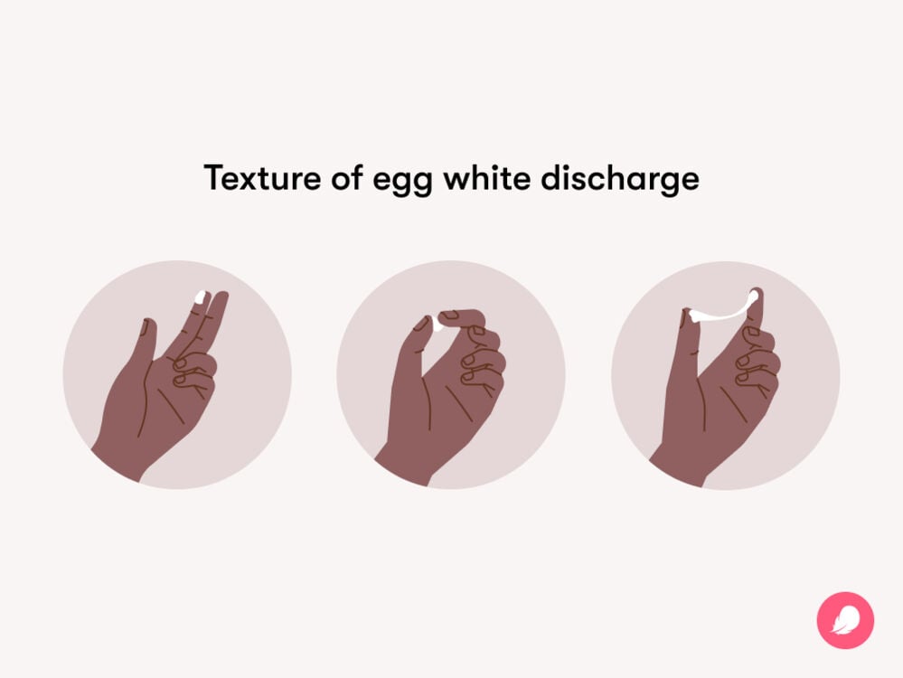 White Vaginal Discharge Before Period