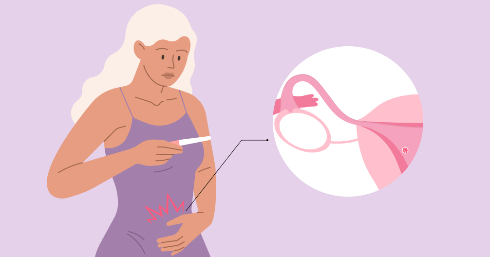 What does implantation cramping feel like? | Flo