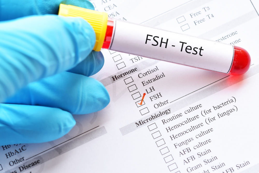 FSH Levels: Follicle-Stimulating Hormone Function in Fertility and ...
